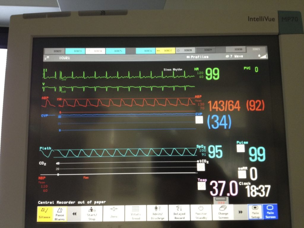 monitor 1 - INTENSIVE