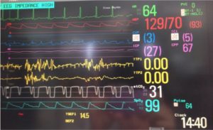 PR monitor 1 - INTENSIVE