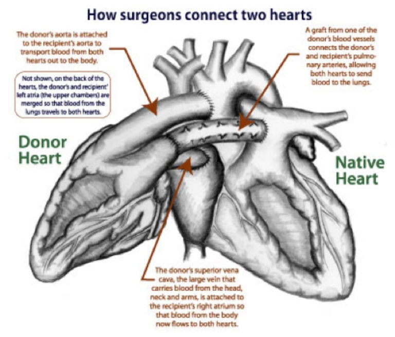 two hearts - INTENSIVE