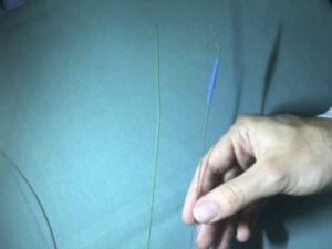 Keep calm and cannulate! - INTENSIVE