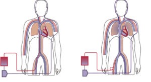 Go with the flow - INTENSIVE