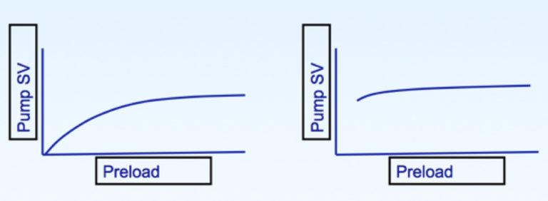 Pump it! - INTENSIVE