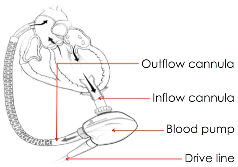 Pump it! - INTENSIVE