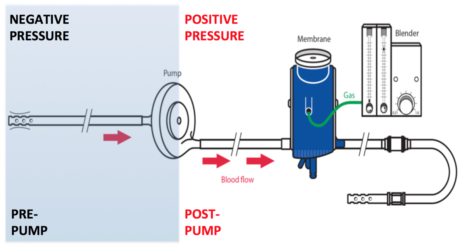 Pressures pre and post-pump diagram - INTENSIVE