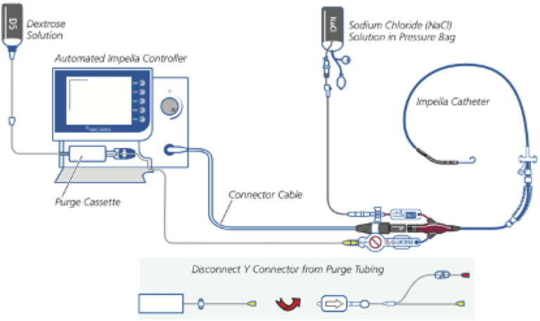 Understanding the Impella ella ella eh eh eh…… Part I! - INTENSIVE